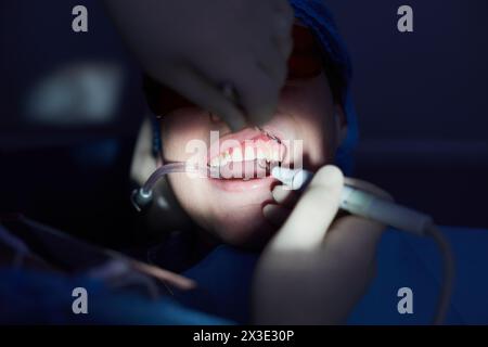 Dentist makes ultrasonic teeth cleaning to patient using special tools ...