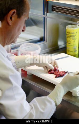 tissue sample selection Thyroid, Anatomic Pathology, Onkologikoa ...