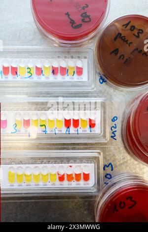 API Microbiology test, Identifying bacteria Laboratory technician ...