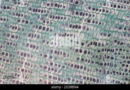 Onion cells under a light microscope at 10 times magnification Stock ...