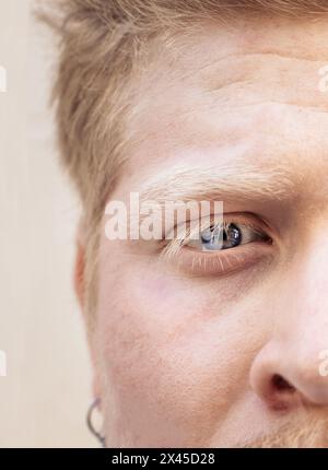 Close up portrait of a Latino albino man's half face. His long white ...