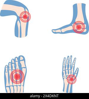 Rheumatology set vector illustration. Cartoon tiny people examine ...