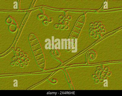 Illustration of Trichophyton mentagrophytes fungi. This fungus causes ...