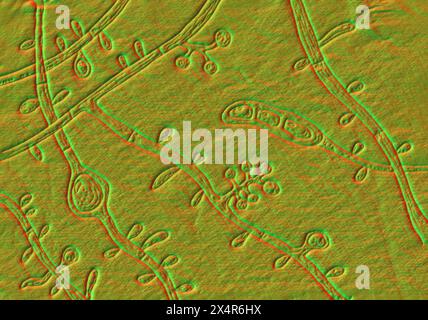 Illustration of Trichophyton tonsurans fungi. This dermatophyte fungus ...