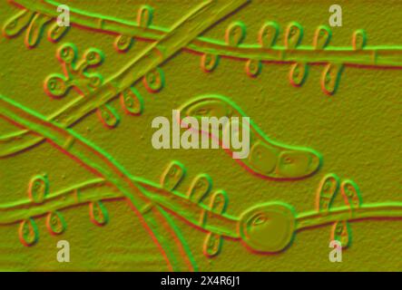 Illustration of Trichophyton tonsurans fungi. This dermatophyte fungus ...