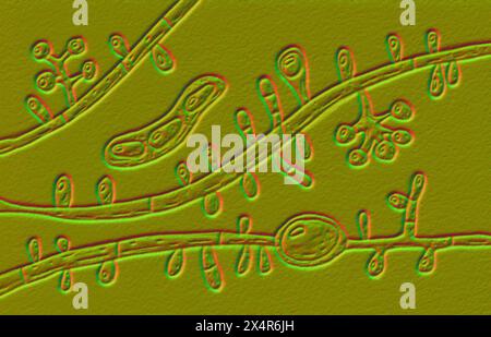 Illustration of Trichophyton tonsurans fungi. This dermatophyte fungus ...