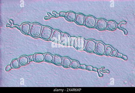 Illustration of the Trichophyton verrucosum (cattle ringworm) fungi ...