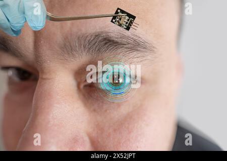 Installing electronic chip into human bionic, neuroprosthetic eye ...