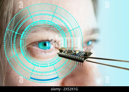 Installing electronic chip into human bionic, neuroprosthetic eye ...