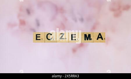 eczema word written on wood block. eczema text on table, concept Stock ...