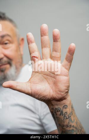 fresh human scar as real medicine background Stock Photo - Alamy