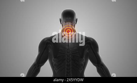 Neck discomfort that trigger pain Stock Photo - Alamy