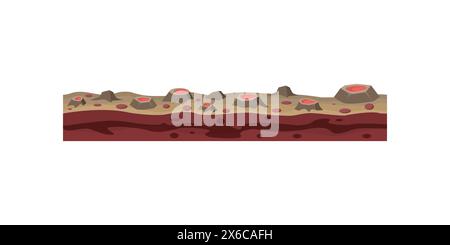 magma lava platform cartoon vector illustration Stock Vector Image ...