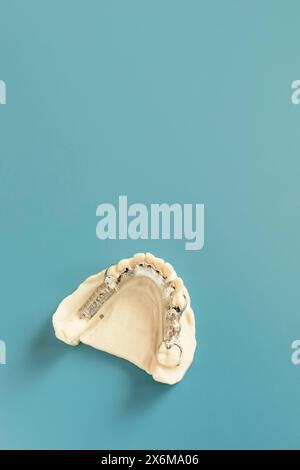 Mockup Metal Frame Lower Partial Denture, Cobalt Chrome Dental Plate ...