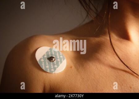 Madrid, Spain. 1 May 2024 Electrodes placed on female chest. Electro ...