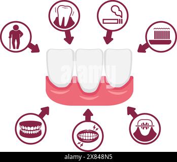 Causes of gingival recession. Vector illustration Stock Vector Image ...