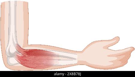 Anatomy of the elbow muscles medical vector illustration Stock Vector ...