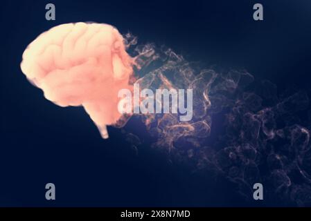 Brain seen from the side. Degenerative disease. Brain degenerative ...