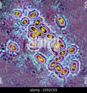 Pneumococcus (Streptococcus pneumoniae), pneumococcus is a bacteria ...