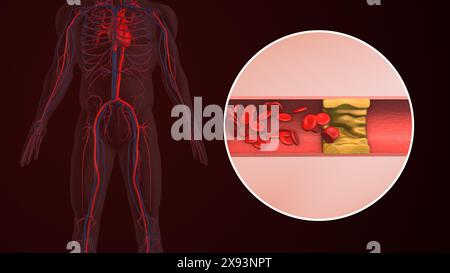 Concept of peripheral pain in human body Stock Photo - Alamy