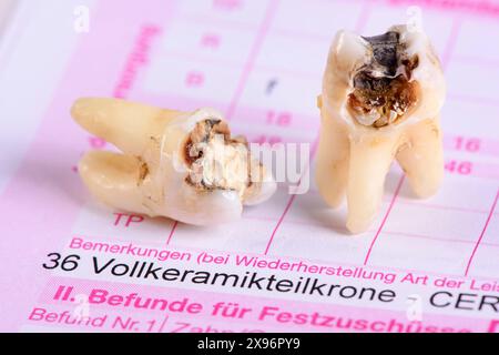 Backenzahn mit Karies und Amalgamfüllung Auf einem Heil- und Kostenplan ...