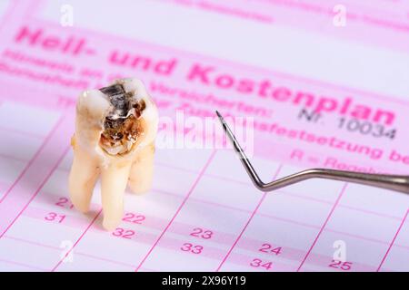 Backenzahn mit Karies und Amalgamfüllung Auf einem Heil- und Kostenplan ...