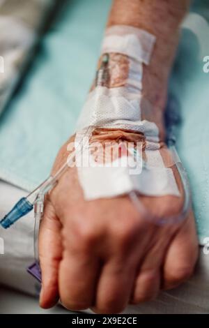 Intravenous lines in patient’s hand Stock Photo - Alamy