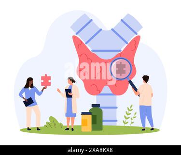 Hypothyroidism concept vector. Endocrinology diagnose and treat human ...