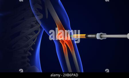 Anatomy Human elbow Joint Treatment Stock Photo - Alamy