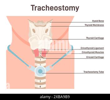 Human trachea airway tube medical diagram icon Stock Vector Image & Art - Alamy
