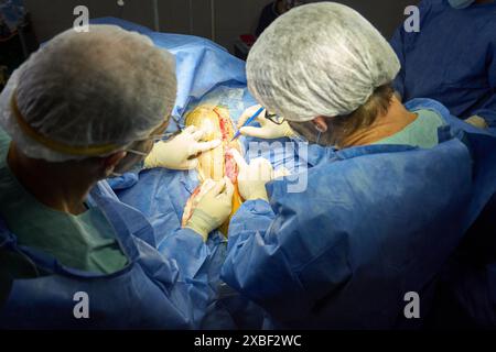 Medical professionals during surgery operating room. Group of surgeons ...