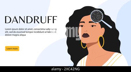 Women's dandruff problem on the head banner. Hair scalp problem. Fungal ...