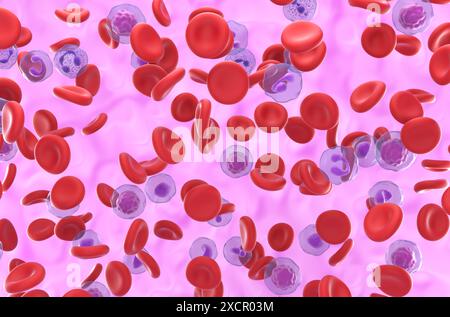 High level of Red blood cell in Polycythemia vera (PV) - closeup view ...