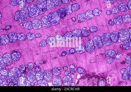 Cardiac muscle. Transmission electron micrograph (TEM) of a ...