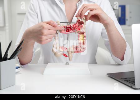Doctor showing model of large intestine at table, closeup Stock Photo ...
