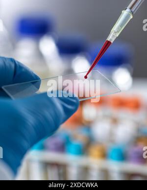 Scientist placing a human blood sample onto a microscope slide for ...