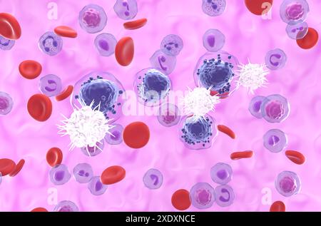 Acute myeloid leukemia (AML) - isometric view 3d illustration Stock ...