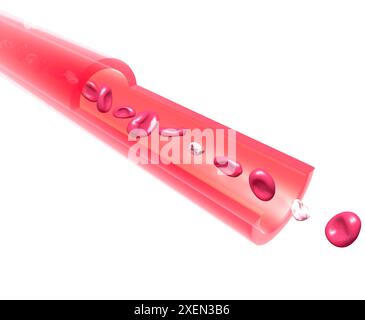 Anatomical 3d illustration of incompetent vein and varicose veins in ...