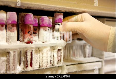 Frozen blood samples, stored samples in refrigerator at -80º C, DNA and ...