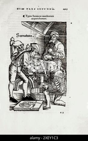 The 16th century illustration of surgery and surgical operations in the ...