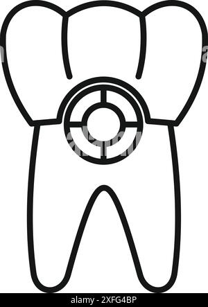Line drawing of a tooth implant procedure showing a dental implant ...