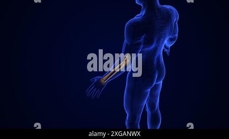 Broken Ulna Bone medical concept Stock Photo - Alamy