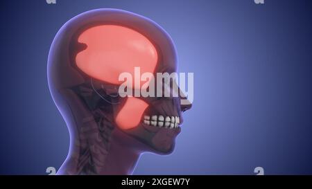 Referred pain from muscle trigger points in the masticatory and neck ...