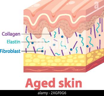 Illustration showing layers and components of aged skin Stock Vector ...