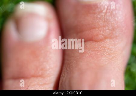 Black toe hairs coming out of the skin in detail Stock Photo - Alamy