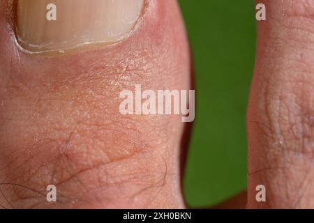 Black toe hairs coming out of the skin in detail Stock Photo - Alamy