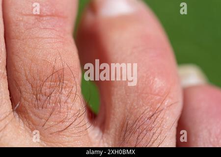 Black toe hairs coming out of the skin in detail Stock Photo - Alamy