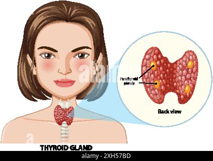 Detailed diagram of thyroid and parathyroid glands Stock Vector Image & Art - Alamy