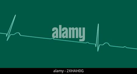 Illustration of an electrocardiogram (ECG) depicting a complete heart ...
