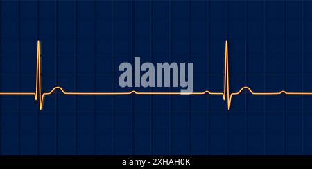 Illustration of an electrocardiogram (ECG) depicting a complete heart ...